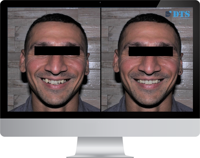 Dental Treatment Simulation Software | DTS