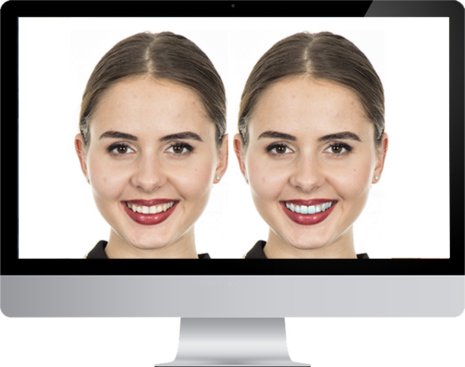 Dental Treatment Simulation Software | DTS