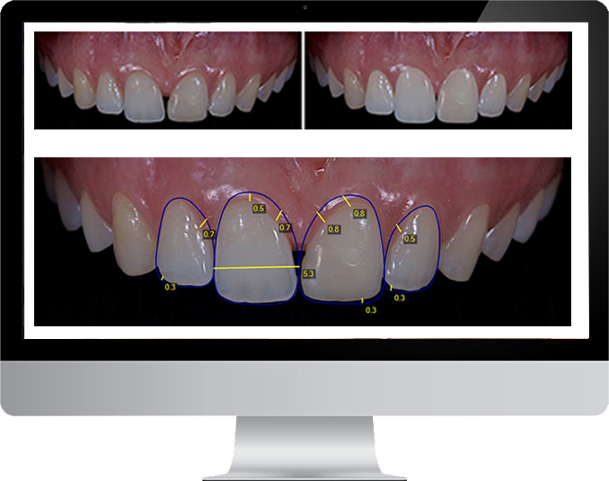 Dental Treatment Simulation Software | DTS