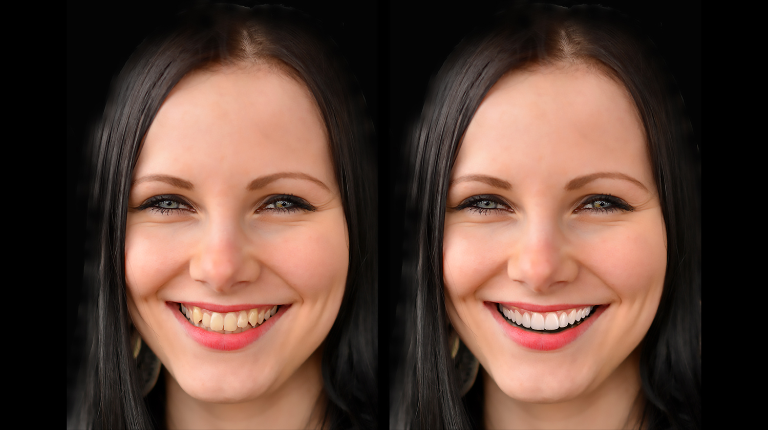 Dental Treatment Simulation & Smile Design Software | DTS