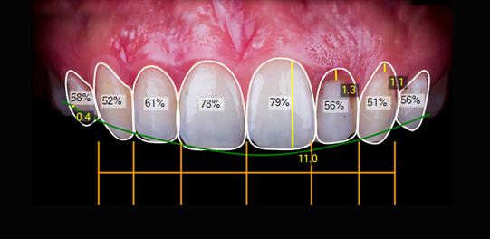 Gallery | Dental Treatment Simulation & Smile Design Software